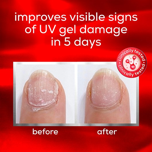Shop To the Rescue UV Gel Damage Repair Treatment | Essie